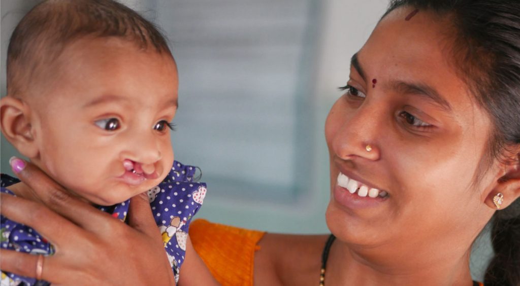 Our story - Northern Cleft Foundation